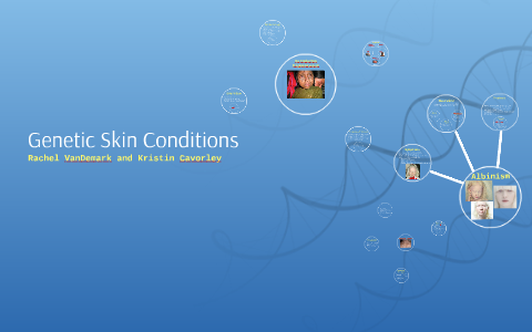 Genetic Skin Conditions by Rachel VanDemark on Prezi