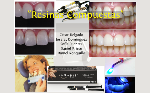Resinas Compuestas by Daniel Rs on Prezi