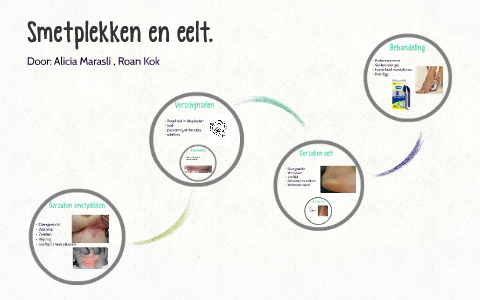 Smetplekken en eelt. by Alicia Marasli on Prezi