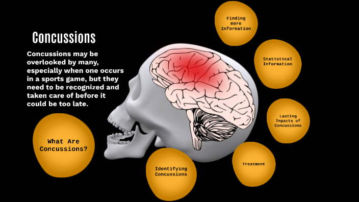 Concussion Awareness by Jonathan Reid on Prezi