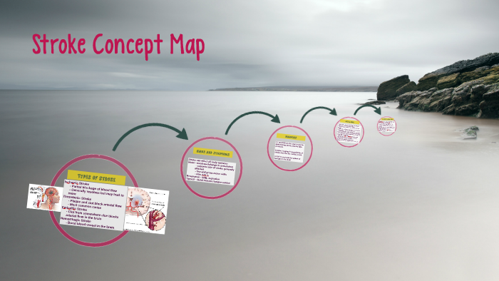 Stroke Concept Map by Lauren Brown on Prezi