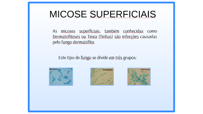 As micoses superficiais, também conhecidas como Dermatofitos by ...