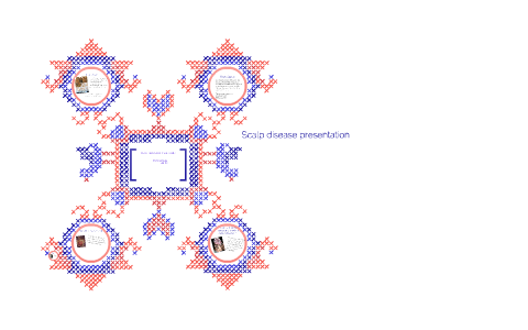 Tinea Favosa and Tinea Capitis: by Amia Conley on Prezi