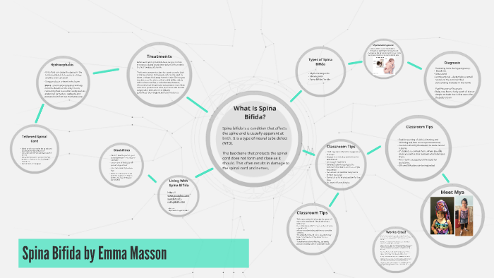 What is Spina Bifida? by Emma Masson on Prezi
