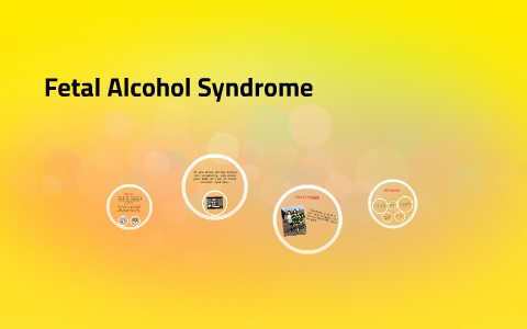 Fetal Alcohol Syndrome by Amy Duclos on Prezi