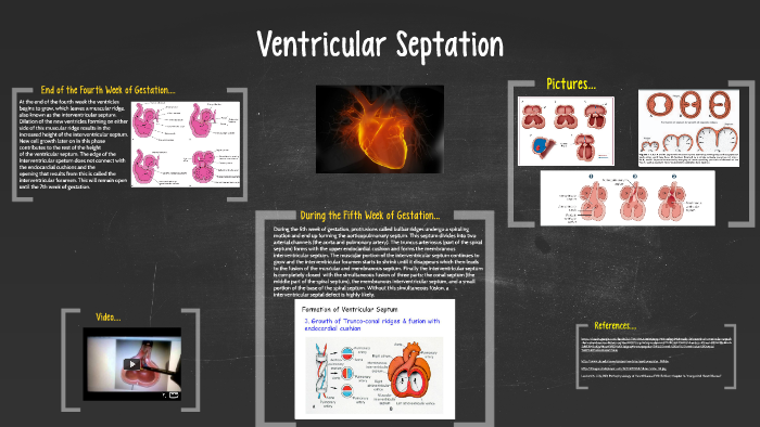 Ventricular Septation by Kayla Buchanan on Prezi