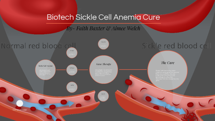 Bio Sickle Cell Anemia PBL by Faith Baxter