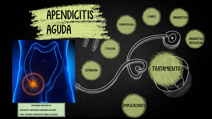 APENDICITIS AGUDA by Gibelli Celina Quispe on Prezi
