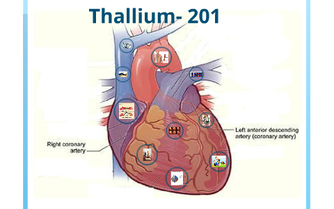 Thallium-201 by John Langley on Prezi