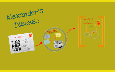 Alexander's Disease by Johnna Foster on Prezi