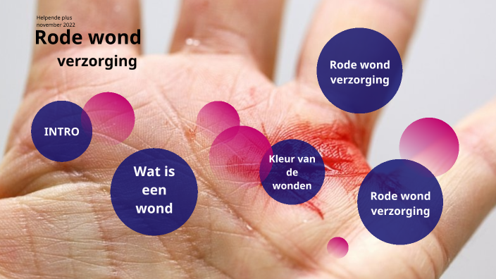 Rode wond verzorging by Joke de Waal on Prezi
