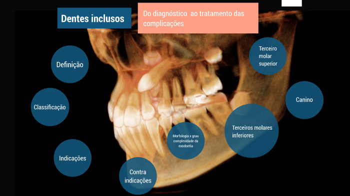 dentes inclusos by Luiz Fernando Araújo on Prezi