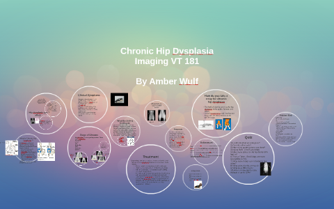 Chronic Hip Dysplasia by Amber Wulf