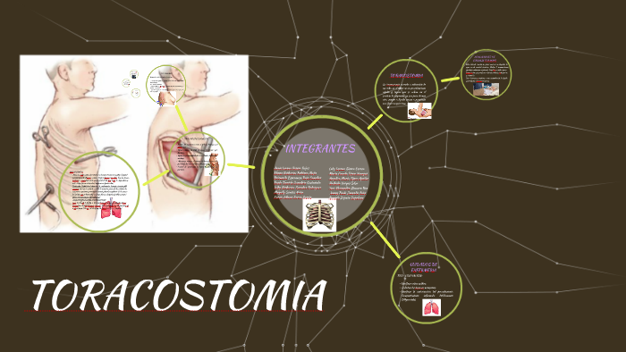 TORACOSTOMIA by Angie Lorena Rosero Rojas on Prezi