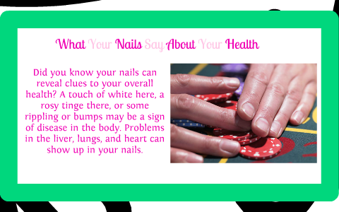 What Your Nails Say About Your Health by Aida shaheen on Prezi