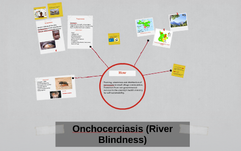 Onchocerciasis (River Blindness) by Juan Ochoa on Prezi