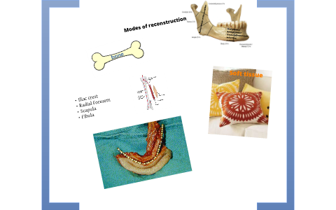 computerized mandibular reconstruction by Ravit Yanko-Arzi