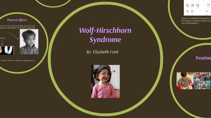 Wolf-Hirschhorn Syndrome by Elizabeth Ford on Prezi