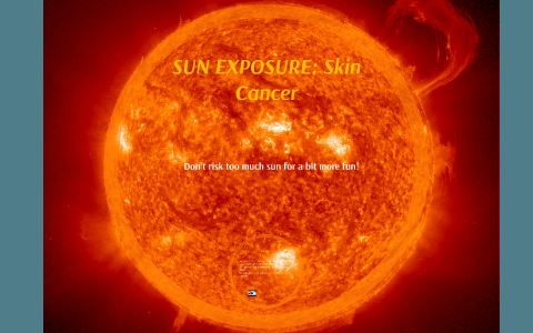 SUN EXPOSURE: Skin Cancer by sam wood