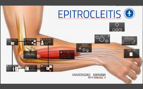 EPITROCLEITIS by Fredy Gonzalez on Prezi