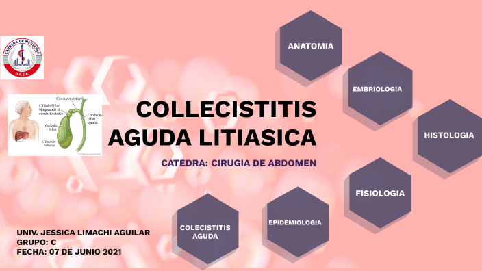 COLECISTITIS AGUDA LITIASICA by JESSICA LIMACHI AGUILAR on Prezi COLECISTITIS AGUDA LITIASICA by JESSICA LIMACHI AGUILAR on Prezi