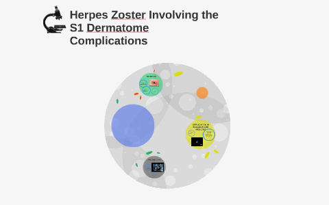 Herpes Zoster Involving the S1 Dermatome Complications by Sindy ...