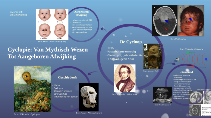 Cyclopie: Van Mytisch Wezen Tot Aangeboren Afwijking by Oguzhan Baser ...