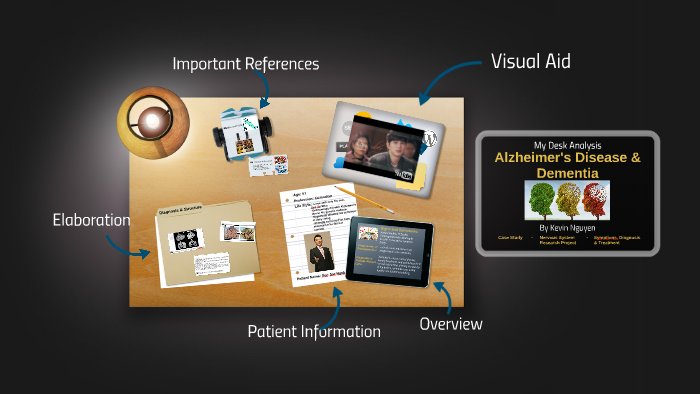Nervous System Research Project by on Prezi