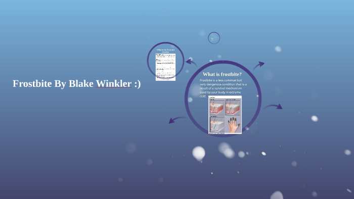 Frostbite By Blake Winkler :) by Blake Winkler on Prezi