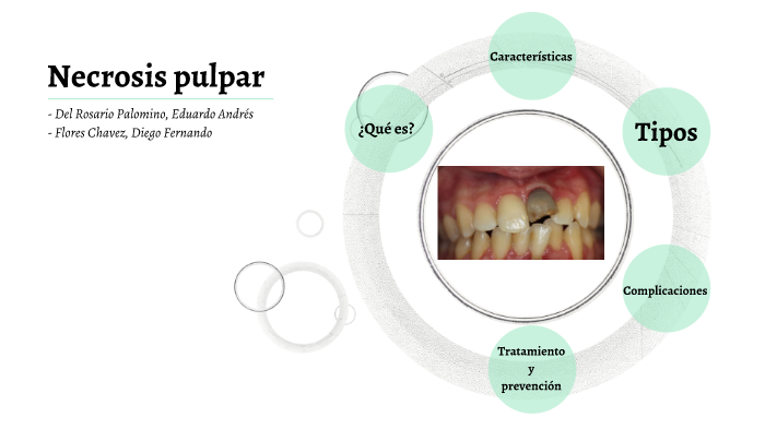 Necrosis pulpar by Eduardo del Rosario Palomino on Prezi