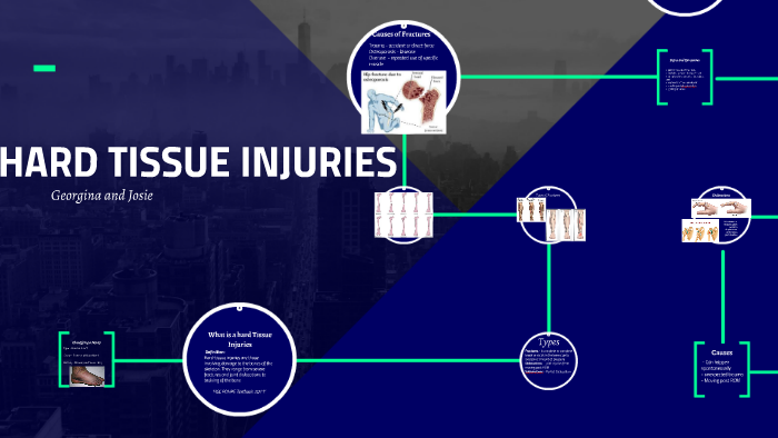 HARD TISSUE INJURIES by Josie McCutcheon