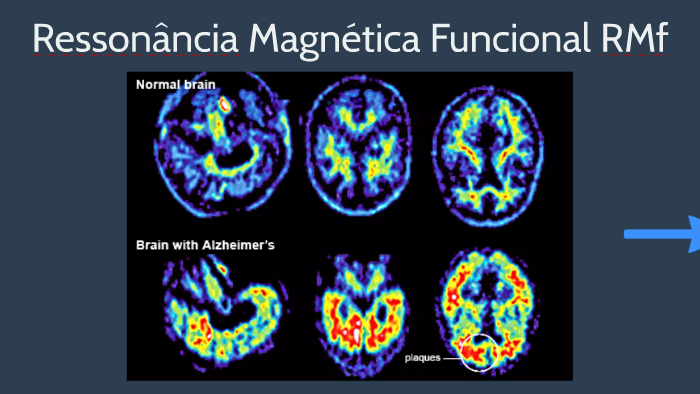 Ressonância Magnética Funcional RMf by Giorgia Coyado on Prezi