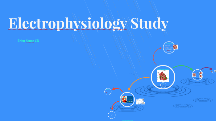 Electrophysiology Study by