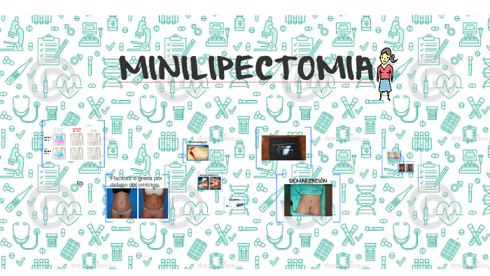 MINILIPECTOMIA by Natalia Benavides on Prezi