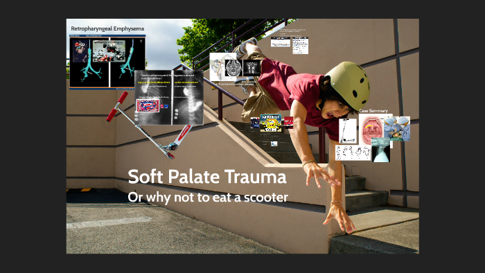 Soft Palate Trauma by Paul Toigo on Prezi