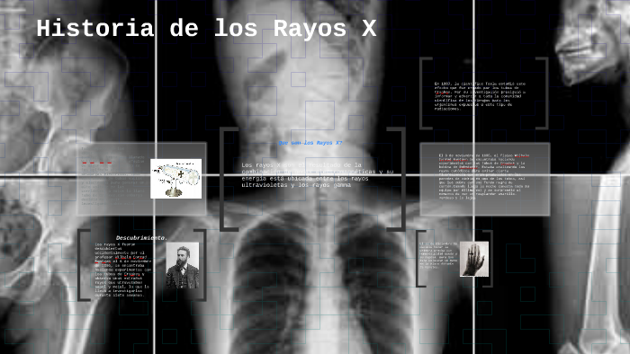 Historia de los Rayos X by Yuli Méndez on Prezi