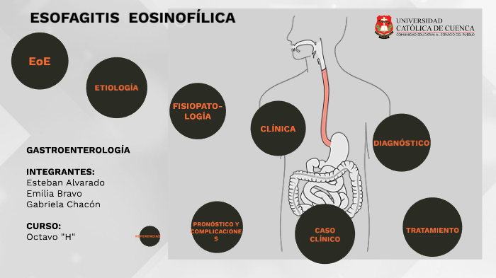 ESOFAGITIS EOSINOFÍLICA by Gabriela Chacón Vera on Prezi