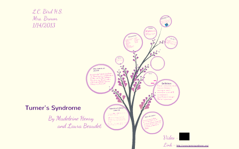 Turner's Syndrome by Laura Beaudet