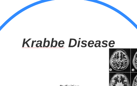 Krabbe Disease by Mallory Gallagher on Prezi