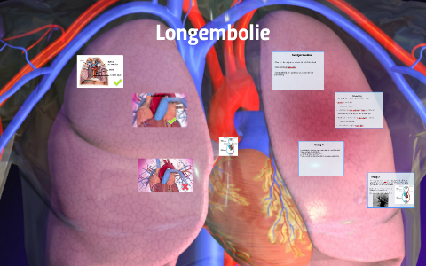 Longembolie by Carolien . on Prezi