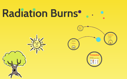 Radiation Burns by amanda r on Prezi