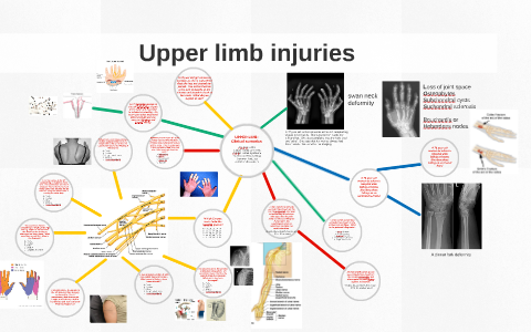 UPPER LIMB: Clinical scenarios by Sarah Camp on Prezi