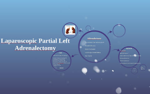 Laparoscopic Partial Left Adrenalectomy by Annie Foliano on Prezi