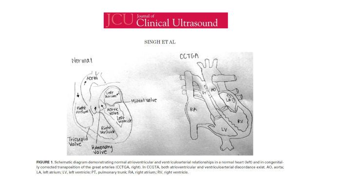 CC-TGA by Alexander Alali on Prezi