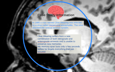The case study of Clive Wearing by on Prezi