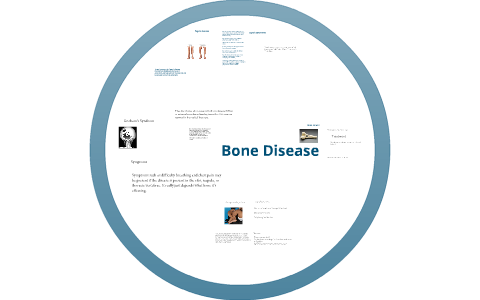 bone disease research by jacob a on Prezi