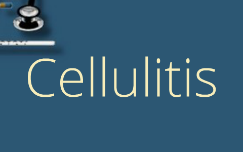 Cellulitis Cks