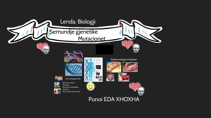 Semundje gjenetike by Adi Mehmeti on Prezi
