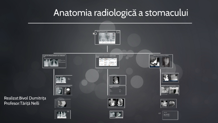 Anatomia radiologică a stomacului by Bivol Dumitrita on Prezi