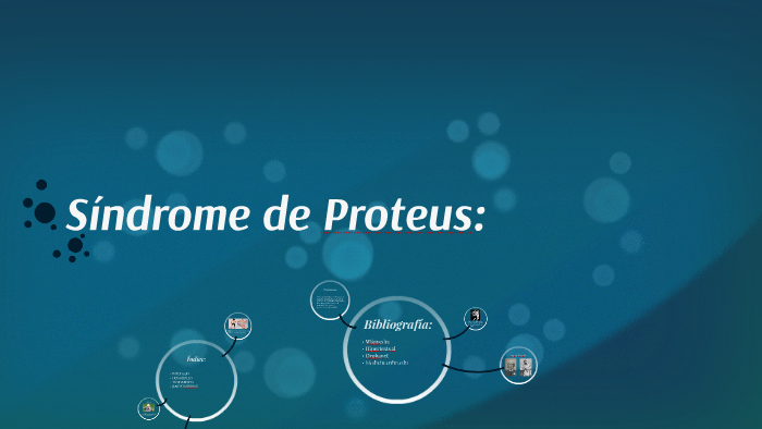 Síndrome de Proteus: by Kendra Varela Figueiras on Prezi